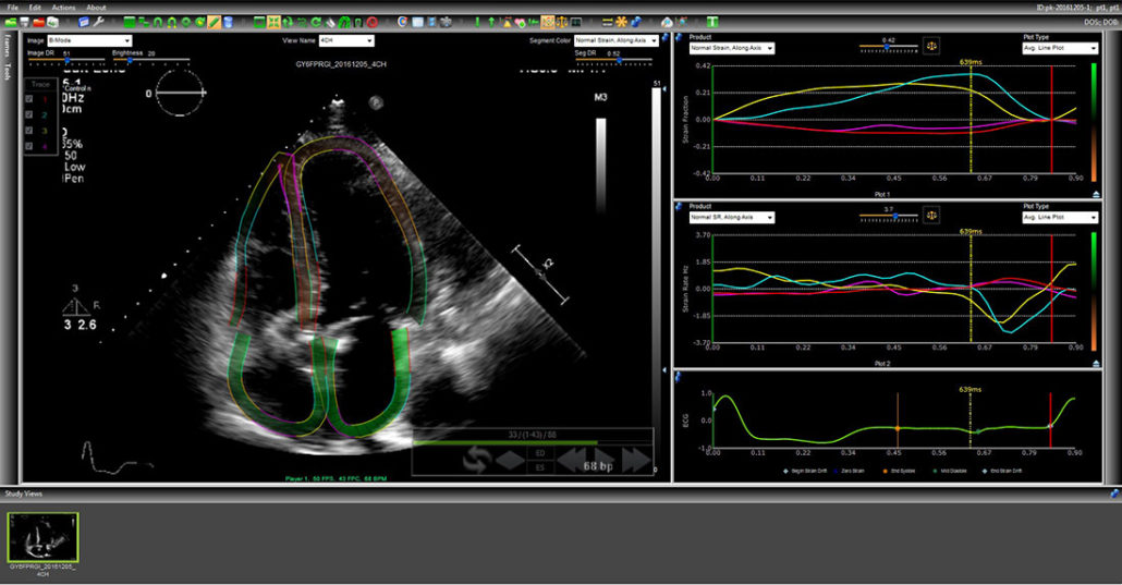 EchoInsight Application: Research - Epsilon Imaging