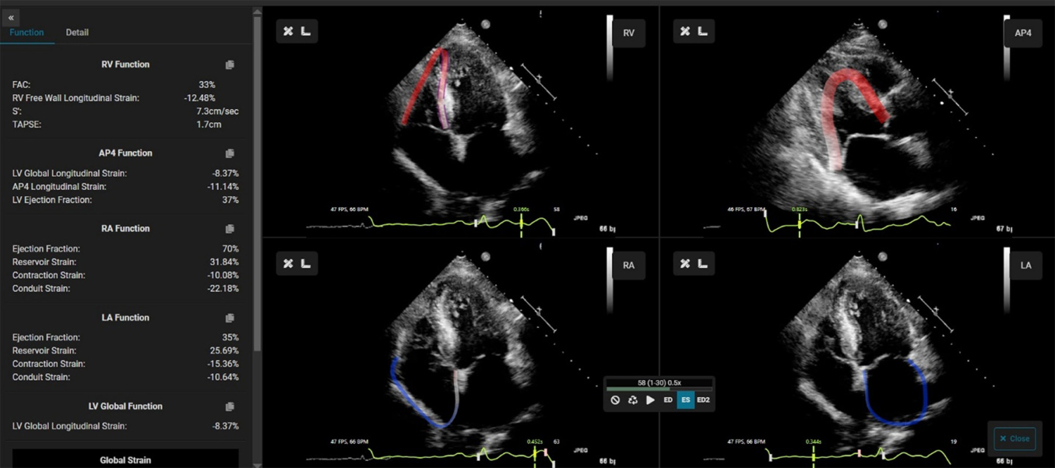 EchoInsight Zero Footprint (ZF) Advanced Clinical License - Epsilon Imaging
