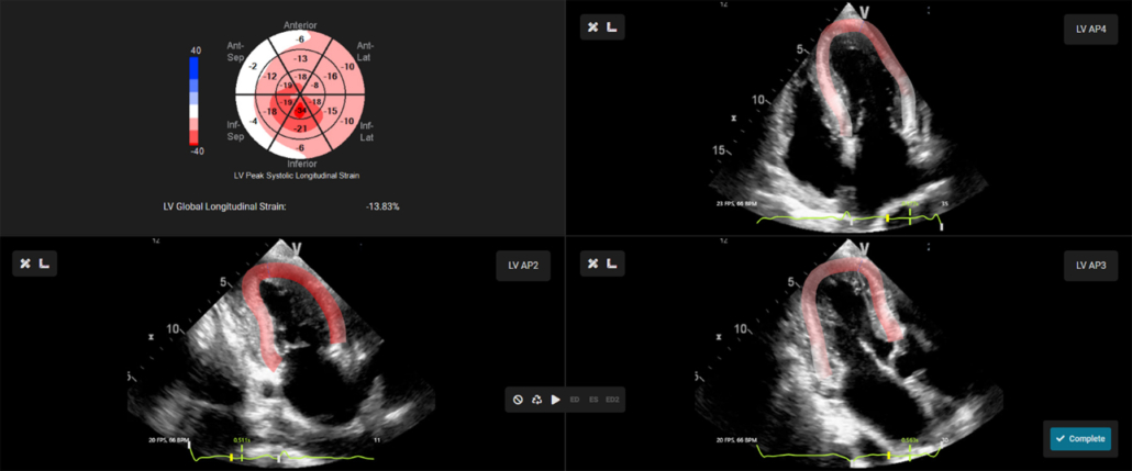 EchoInsight Zero Footprint (ZF) Clinical License - Epsilon Imaging